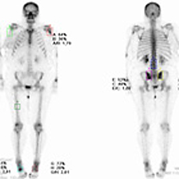 Szintigraphie Untersuchungs-Information - Radiologie Dachau
